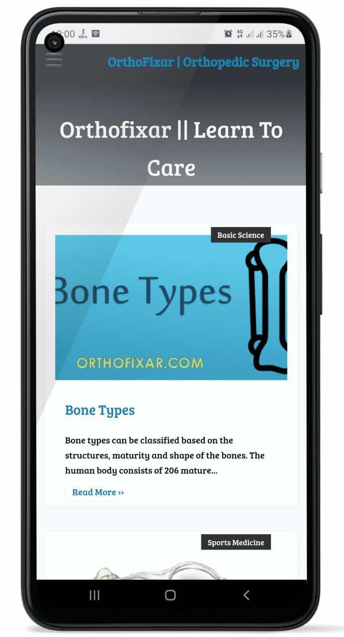 Wrist Anatomy • Easy Explained - OrthoFixar 2022